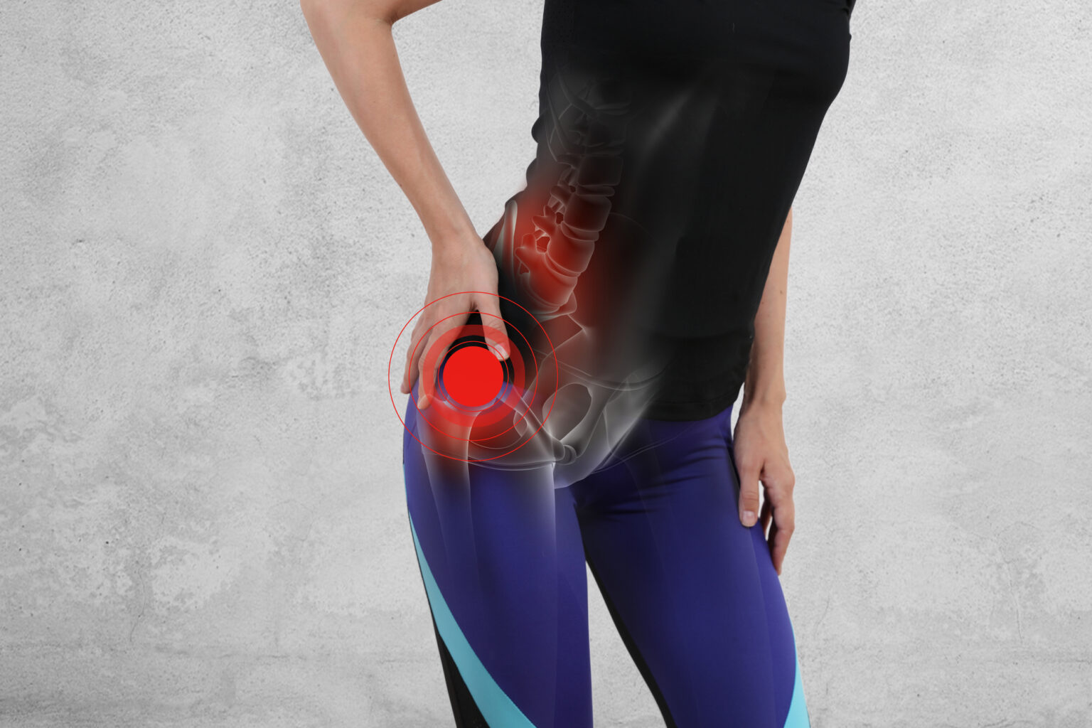 Hip Bursitis & Outer Hip Pain: Here’s Everything You Should Know ...